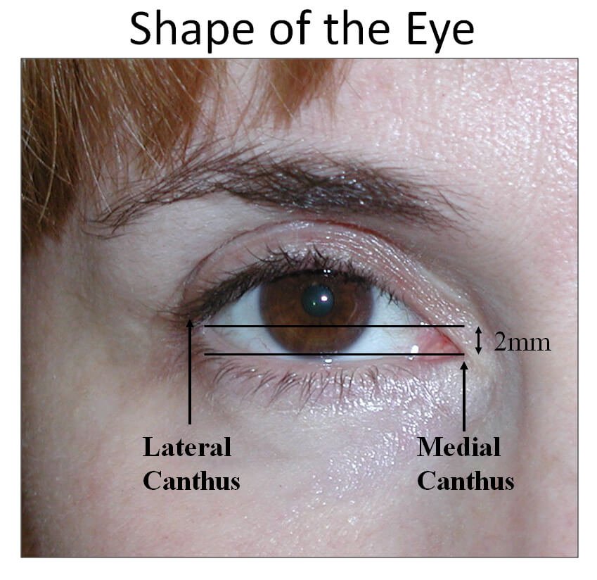 Eyelid lift / Blepharoplasty | Facial Plastic Surgeon